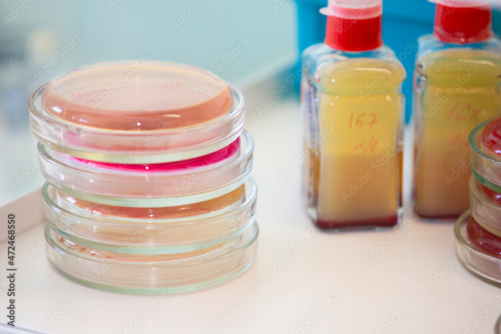 Bacterial colonies of streptococci with alpha hemolytics on a blood ...
