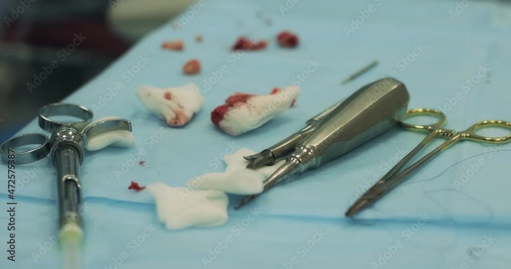 Surgical dental instruments on the table during an operation to remove ...