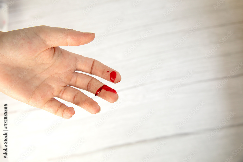 hand injury with blood, blood wound cut top view, copy space, medical ...