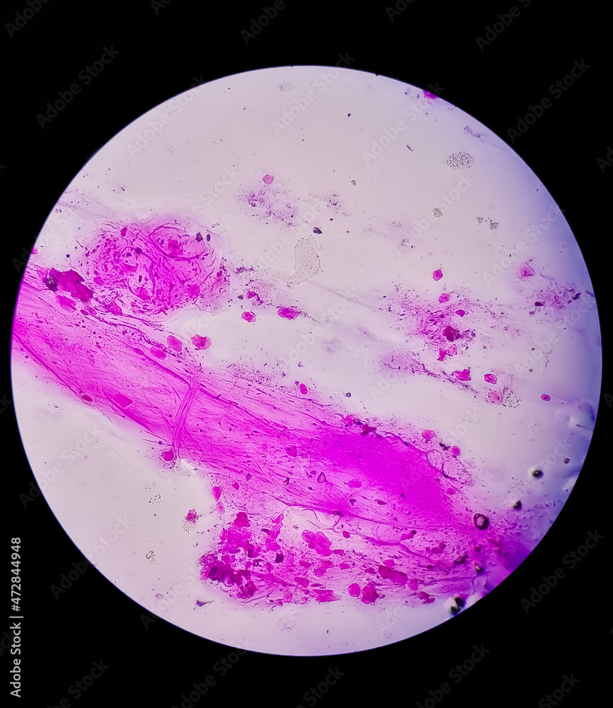 Gram staining, also called Gram's method, is a method of ...