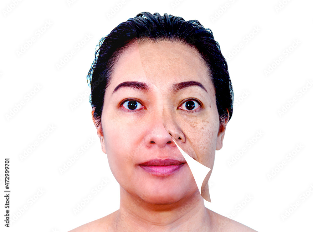 Asian woman face before and after retouch isolated on white . Skin ...