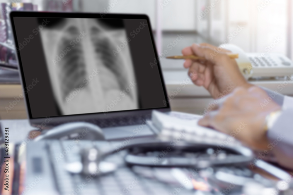 Blurred image of doctor work on laptop computer with chest x-ray film ...