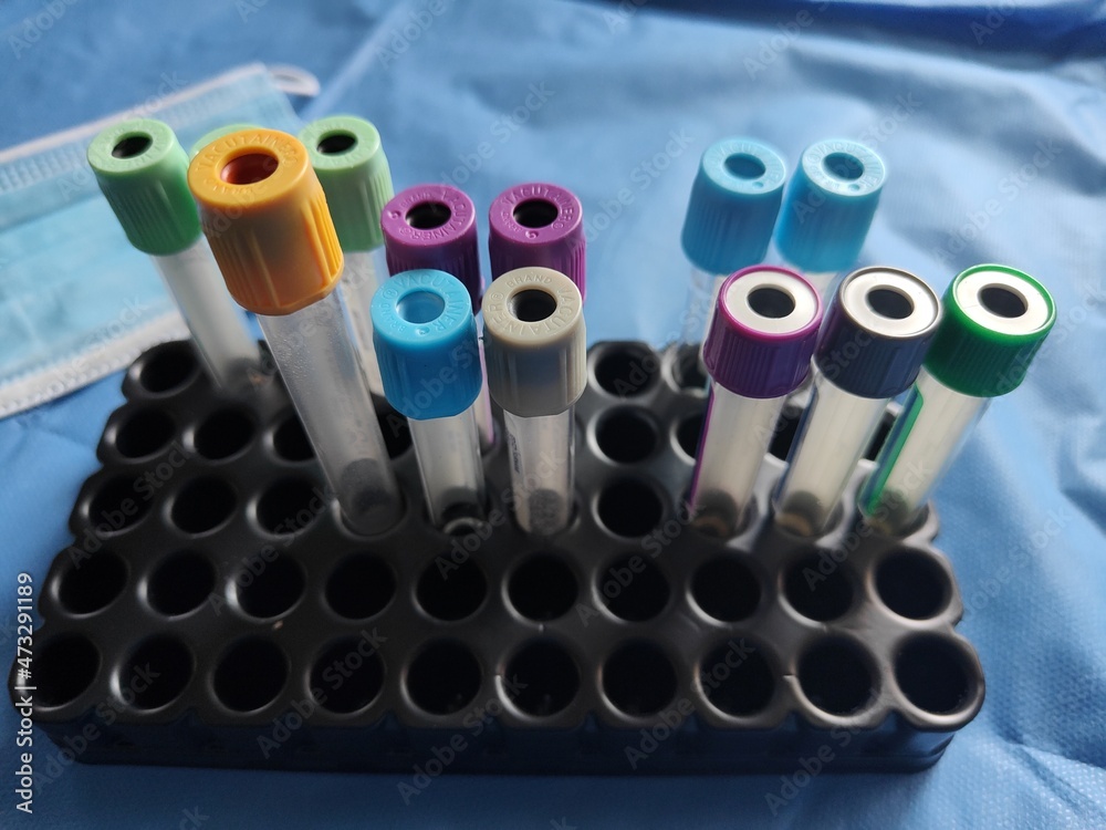 Tubos de muestra de laboratorio Stock Photo | Adobe Stock