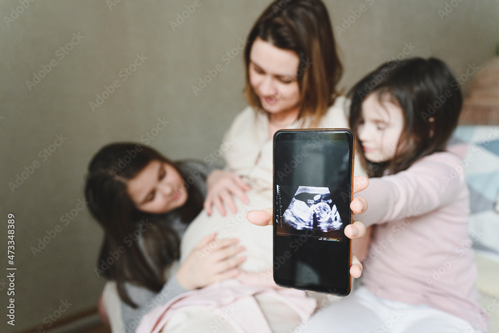 Curious daughter with mobile phone showing ultrasound embryo of baby at ...