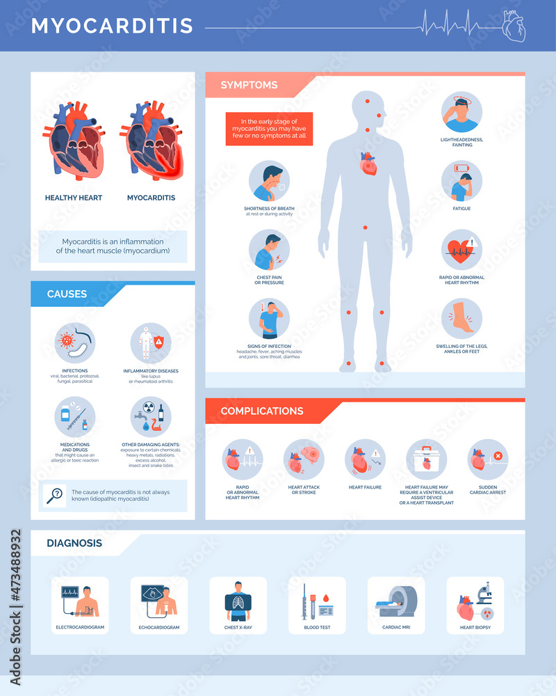 Myocarditis medical infographic with heart section Stock Vector | Adobe ...
