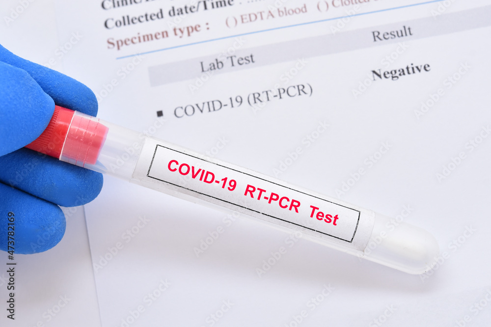 Nasopharyngeal swab from patient for COVID-19 test by using RT-PCR ...
