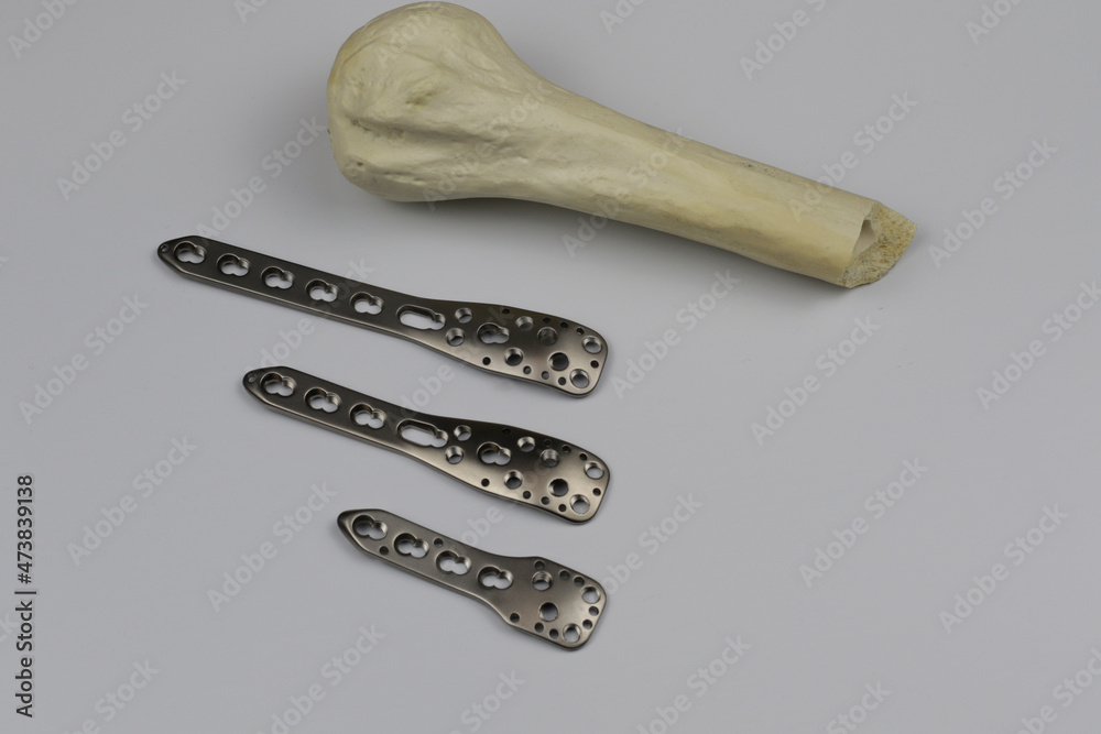 Surgical instruments in case of operation bones fractures Stock Photo ...