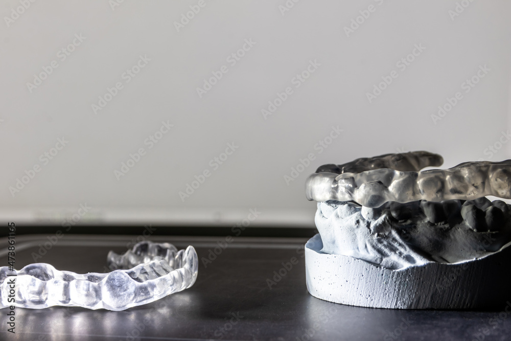 Dental splint against bruxism and grinding teeth with teeth imprint and ...