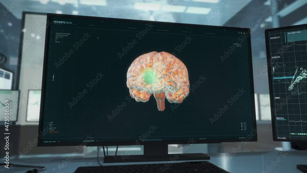 Interface of the equipment used at the modern medical center. Interface ...