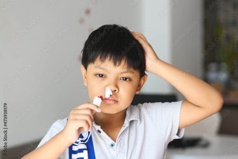 An Asian young boy using tissue to stop the nose bleeding. Stock Photo ...