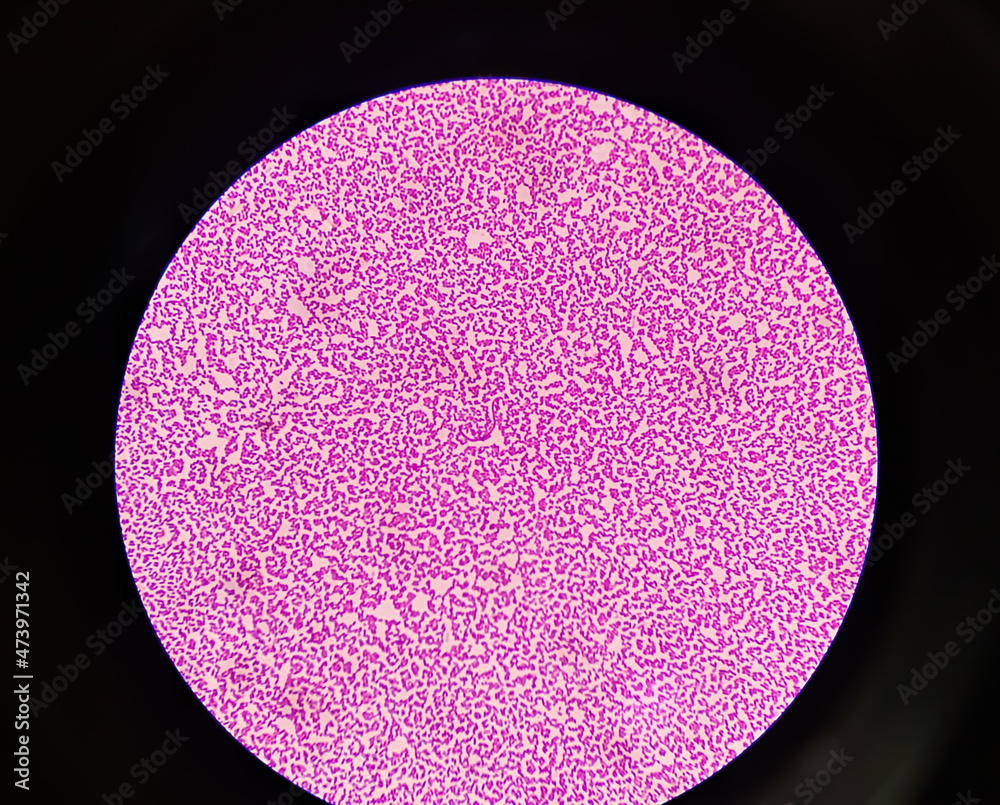 Blood culture colonies gram stained microscopic 100x show Salmonella ...