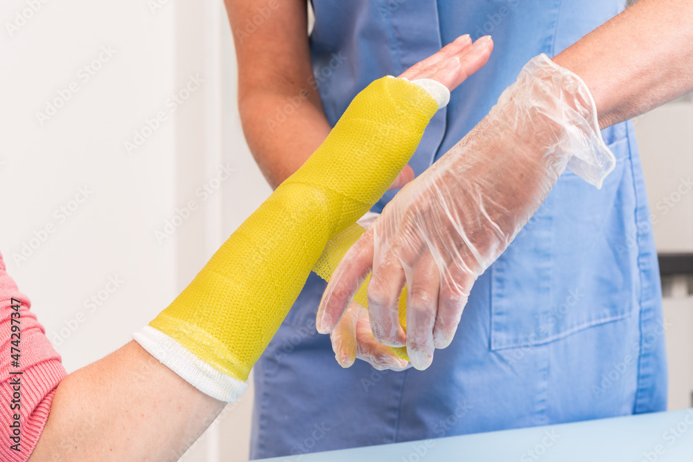 Surgery and Medical theme: Close up of an arm and wrist plaster ...