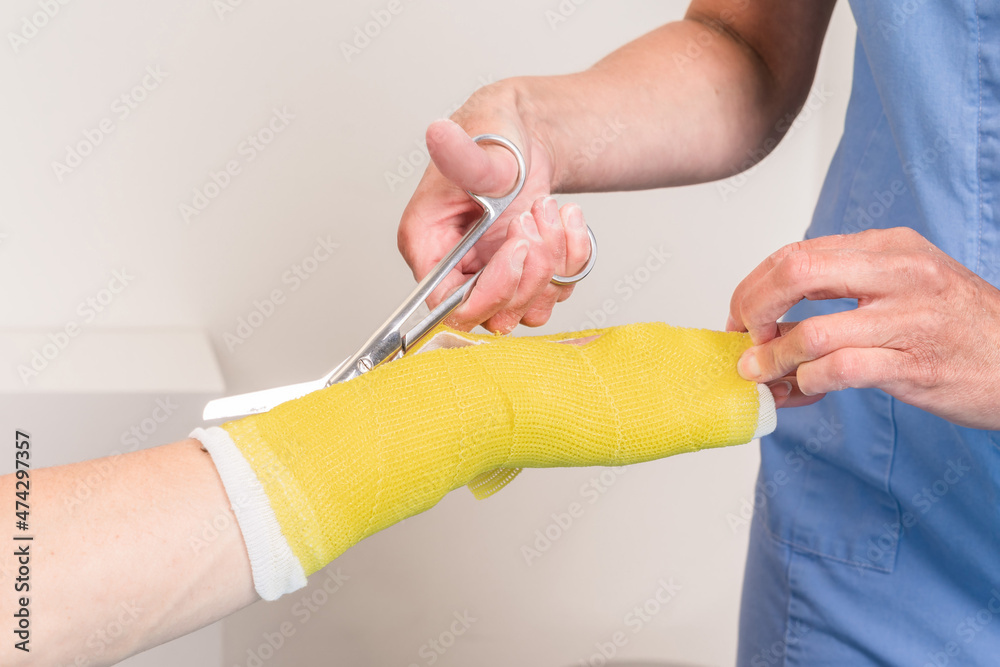 Surgery and Medical theme: Close up of an arm and wrist plaster ...