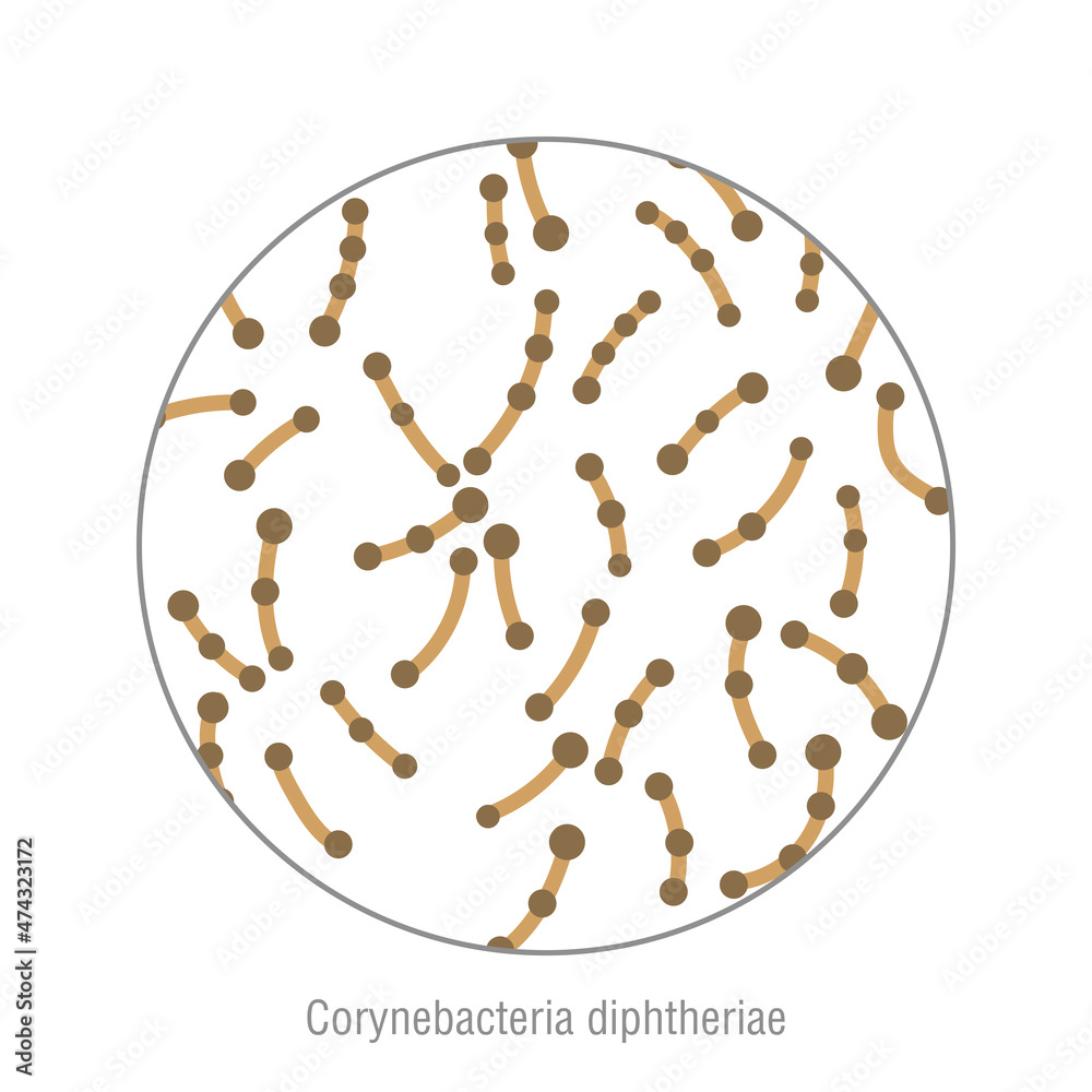 Corynebacterium diphtheriae, pathogenic bacteria. Bacterial ...