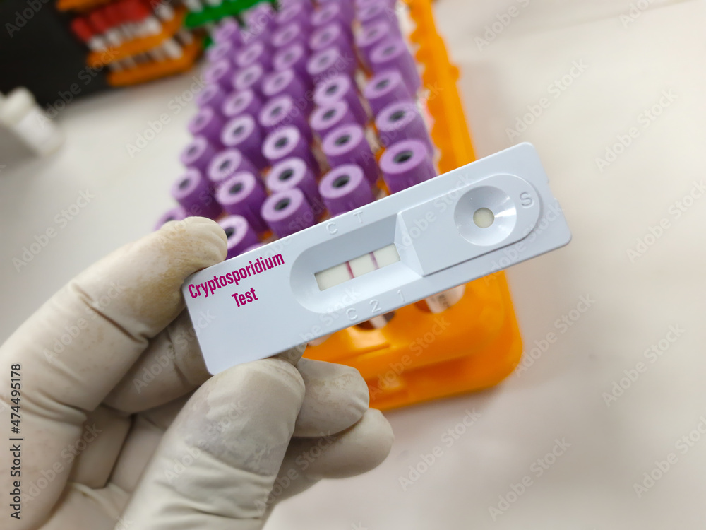 Rapid test cassette for Cryptosporidium test, to diagnosis of ...