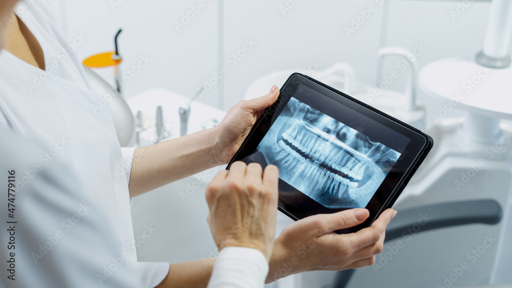 Dentist showing x ray picture to her patient Stock Photo | Adobe Stock