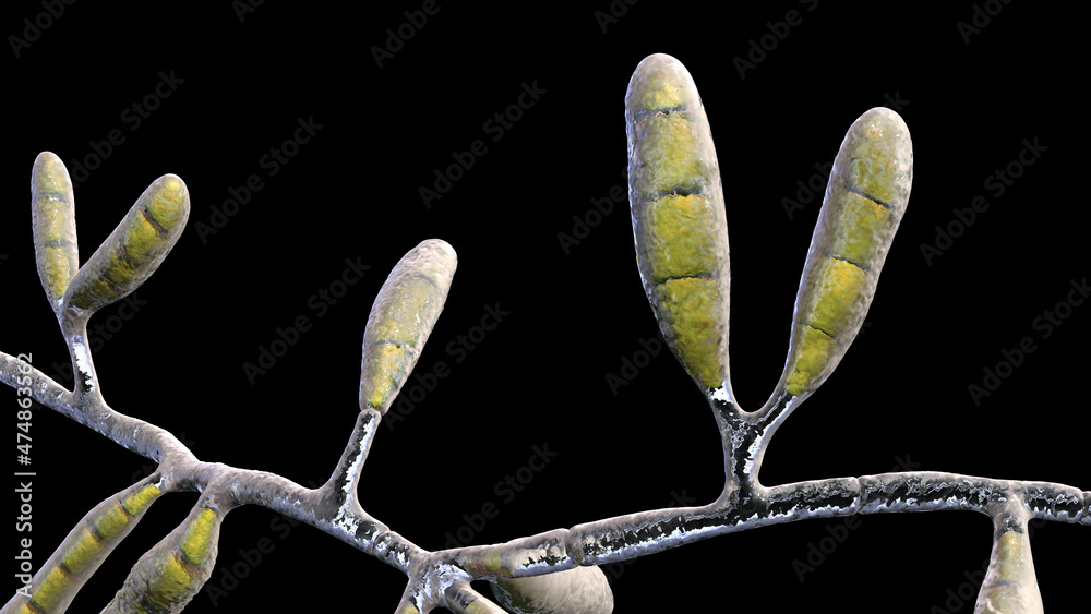 Microscopic fungi Epidermophyton floccosum, scientific illustration ...