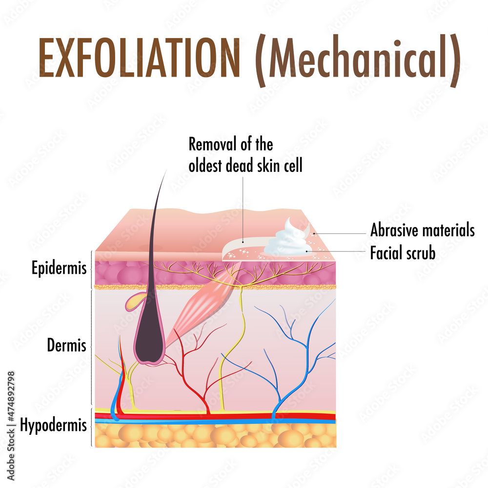 Exfoliation. Peeling or Physically scrubbing. Exfoliation is removal of ...
