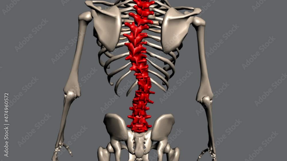 scoliosis, curvature of the spine, hump, skeleton Stock Video | Adobe Stock