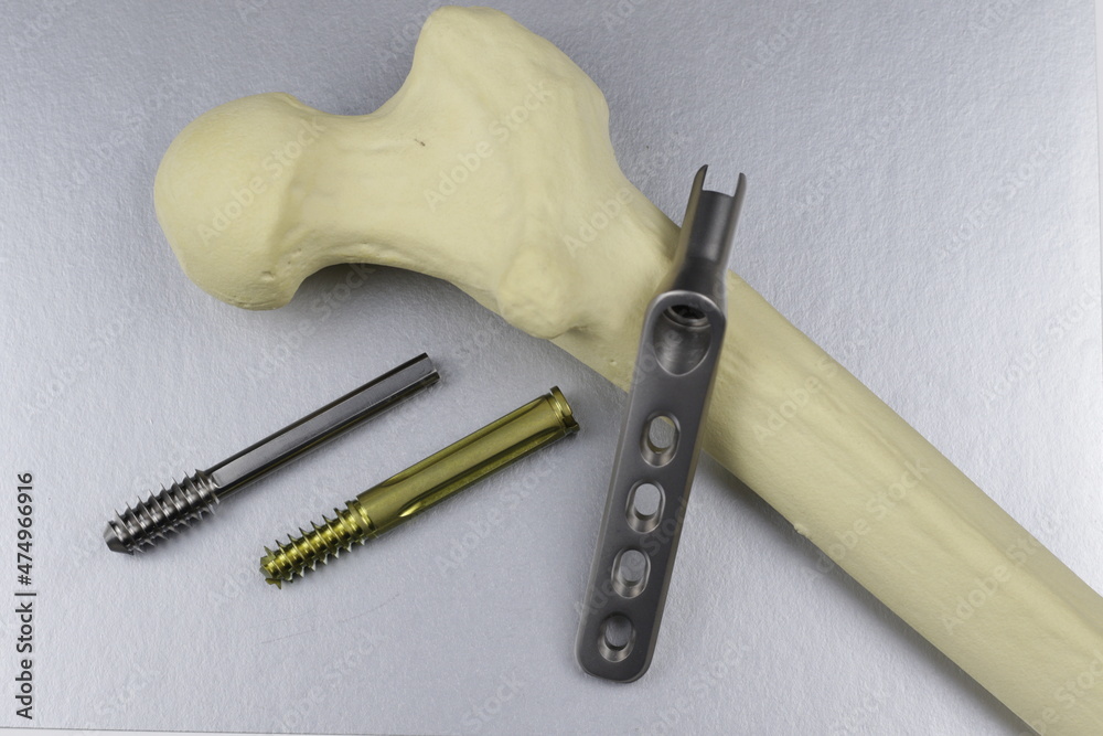 Surgical instruments in treatment of bone fractures Stock Photo | Adobe ...