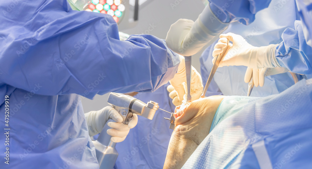 A team of doctor doing orthopaedic surgery inside modern operating room ...