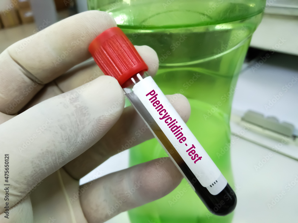 Blood sample tube for doping drugs phencyclidine test. To determine ...