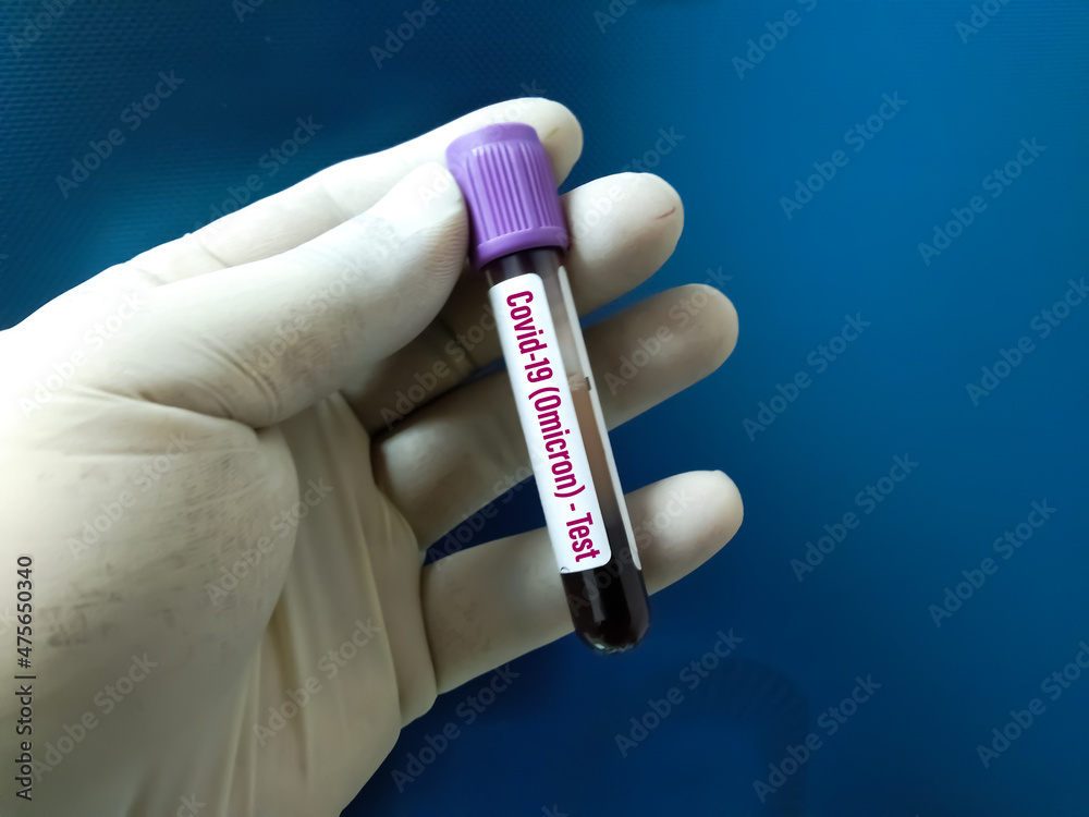 Omicron positive, blood sample tube positive with Omicron or B.1.1.529 variant of COVID-19 ...