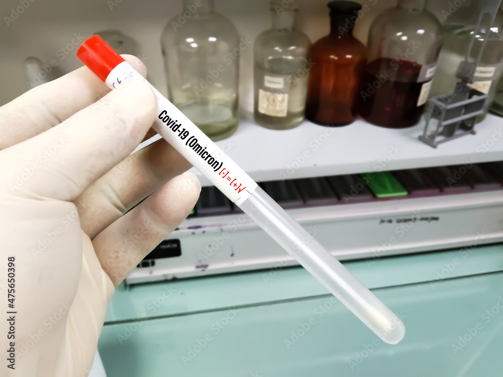 Oropharyngeal swab from patient for COVID-19 test by using RT-PCR ...