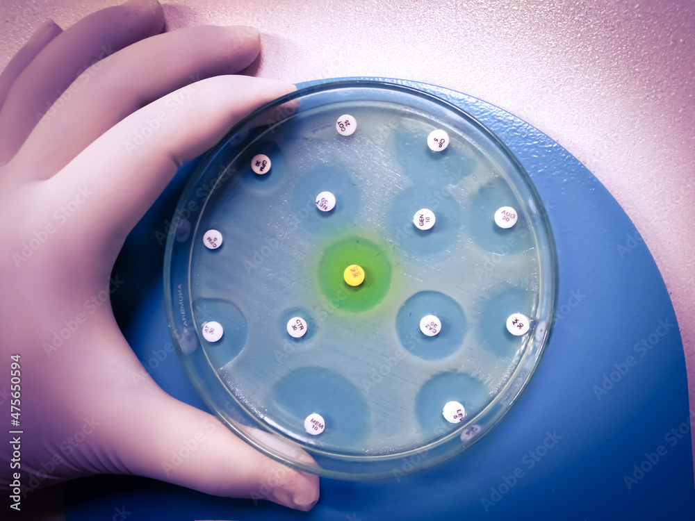 Antimicrobial susceptibility testing in culture plate. Drug sensitivity ...