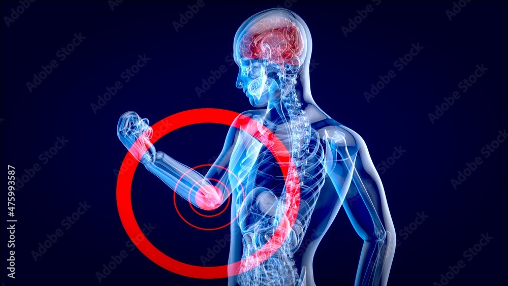 4K anatomy concept of an elbow pain Stock Illustration | Adobe Stock