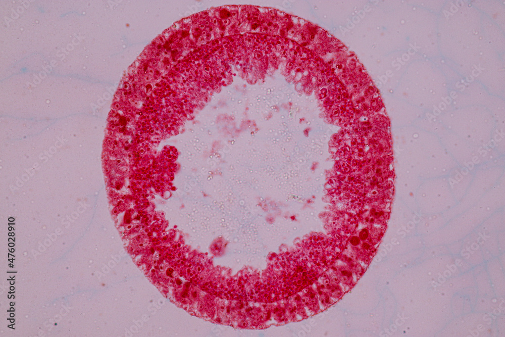 Hydra is a genus of small, fresh-water animals of the phylum Cnidaria ...