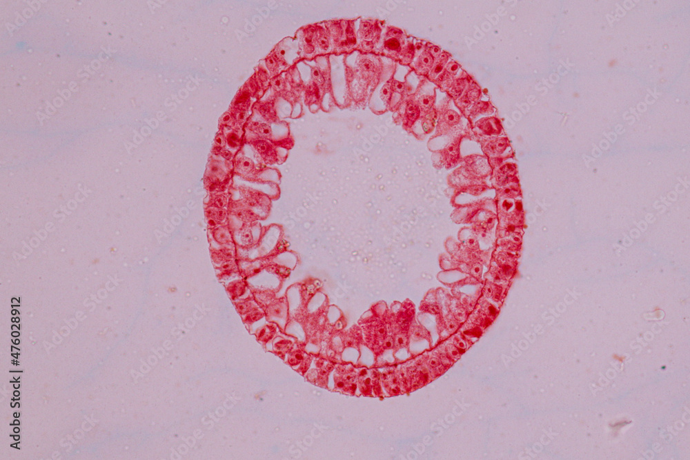 Hydra is a genus of small, fresh-water animals of the phylum Cnidaria ...