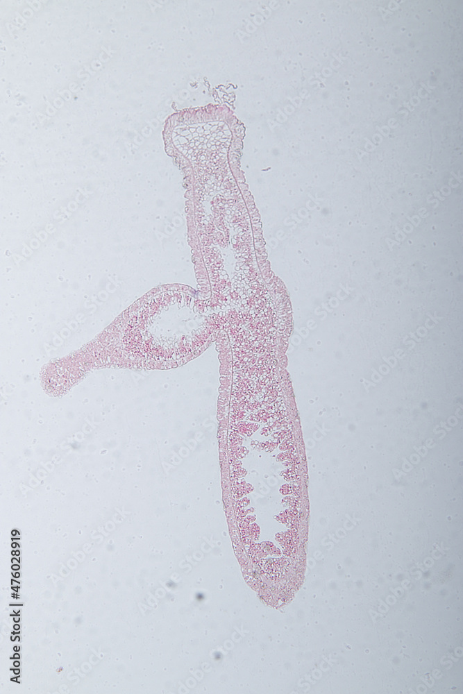 Hydra is a genus of small, fresh-water animals of the phylum Cnidaria ...