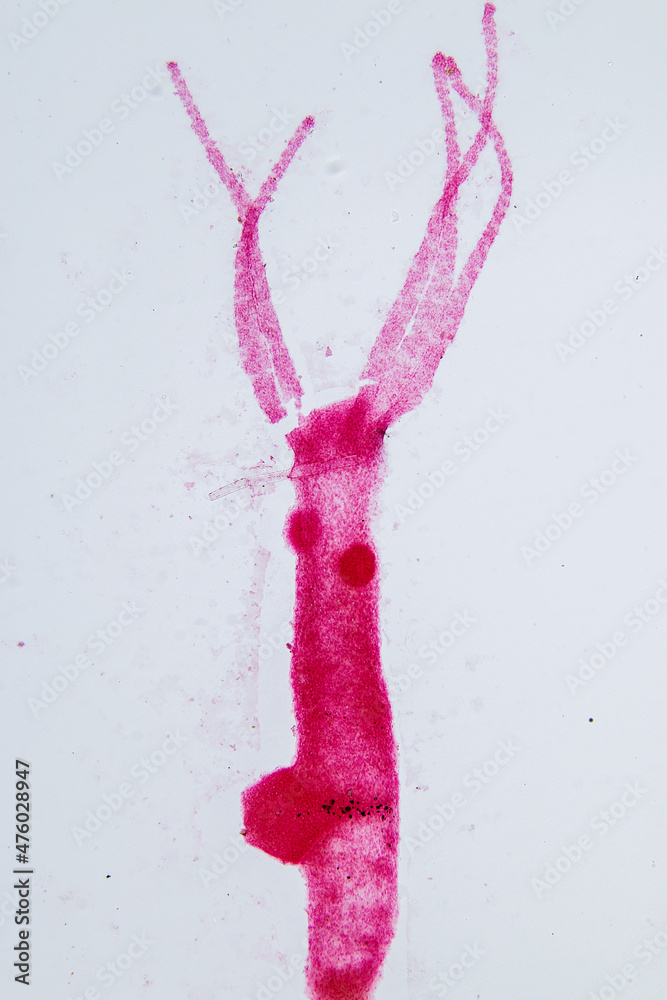 Hydra is a genus of small, fresh-water animals of the phylum Cnidaria ...