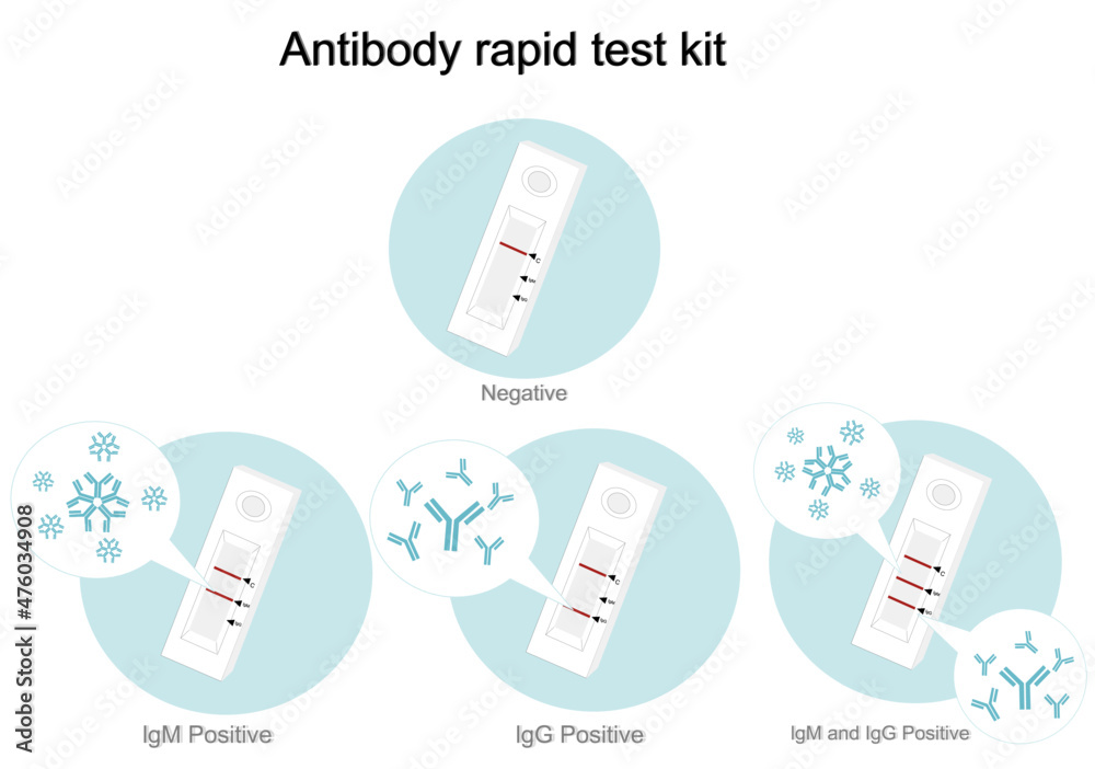 The result of antibody rapid test kit or lateral flow test ...