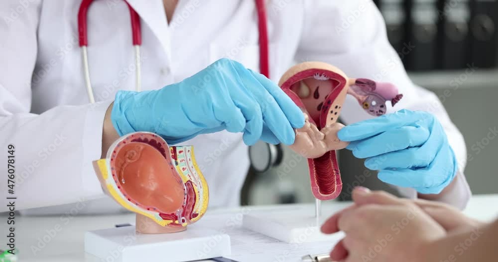 Doctor gynecologist showing patient fertilization process on artificial ...