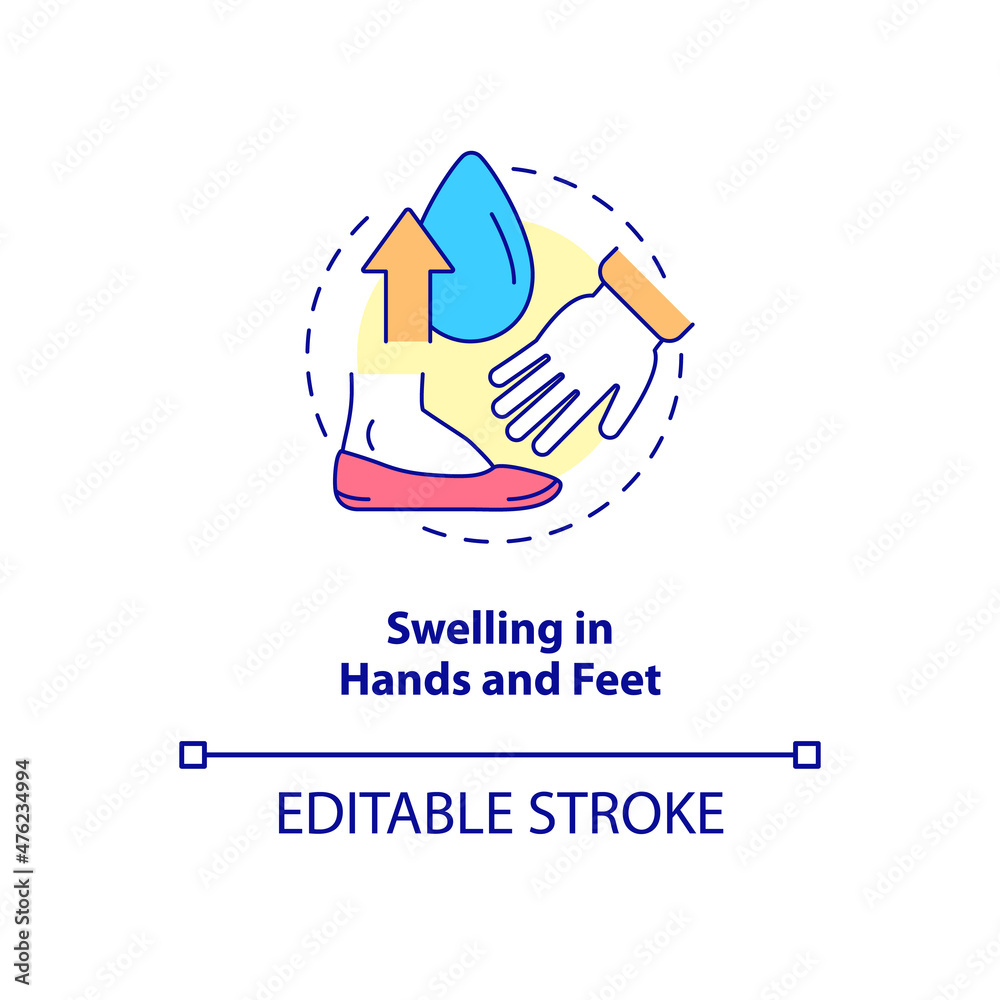 Swelling in hands and feet concept icon. Limbs enlargement. Edema ...