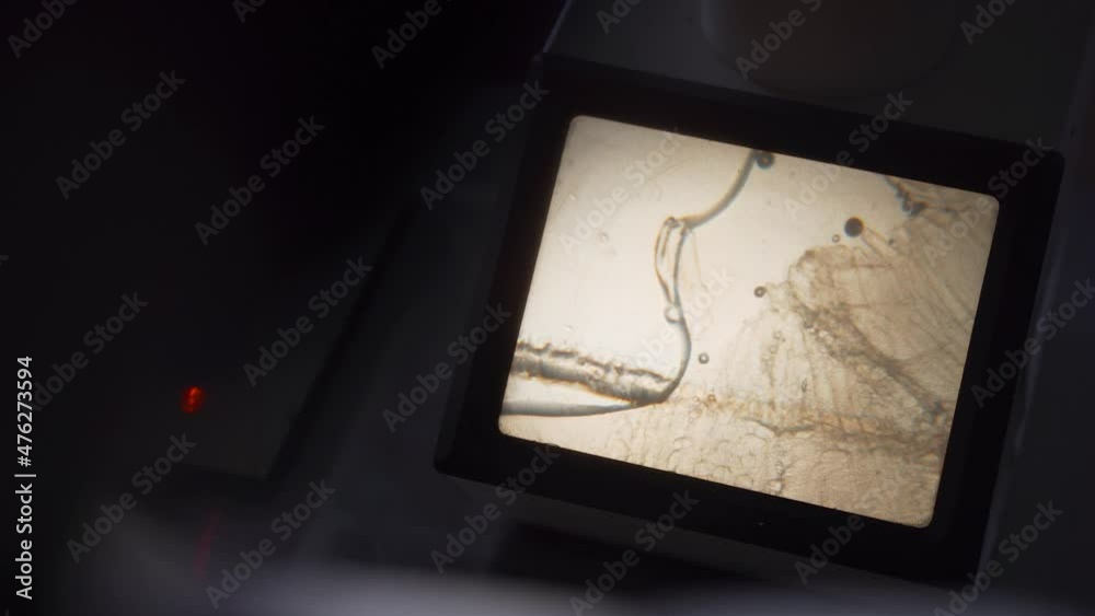 The screen of the microscope. Meat under a microscope. Cell structure ...