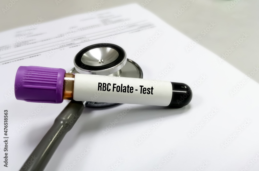 Blood sample tube for RBC Folate test. To measures the amount of folate ...