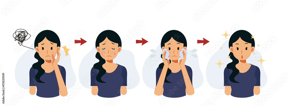 Acne concept.pimples. skin problems. step of Clear of acne. cleaning ...