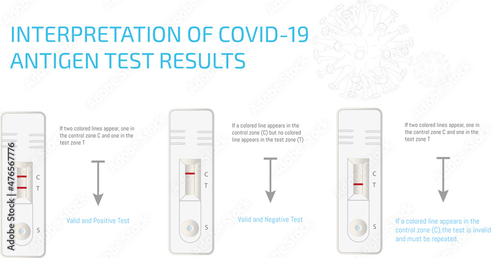 Interpretation of Covid-19 antigen test results. The infographic chart ...