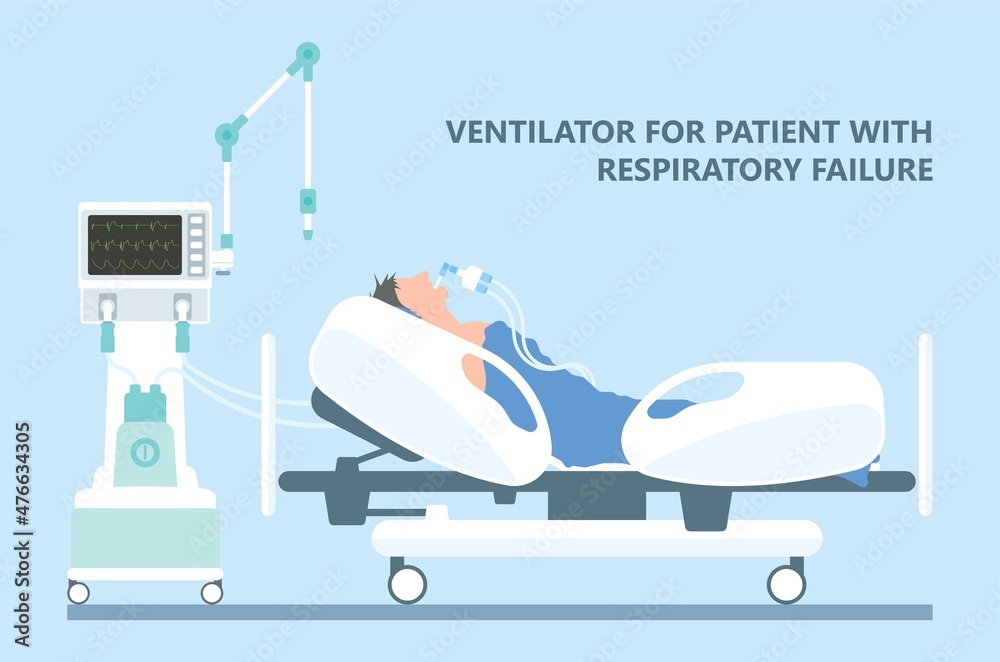 Acute respiratory distress syndrome (ARDS) a respiratory failure and ...