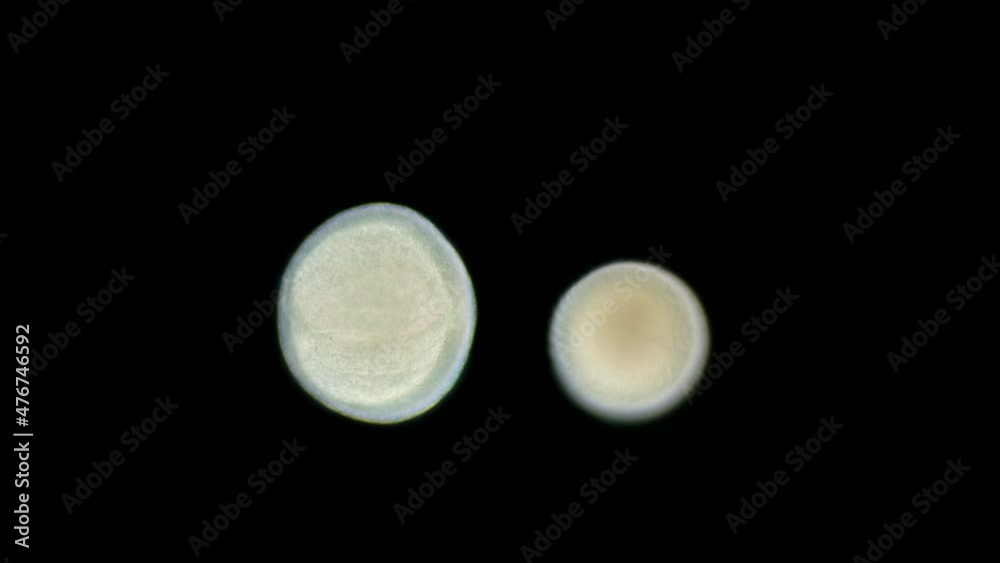 Planula coral larva under a microscope, class Anthozoa, possibly order ...