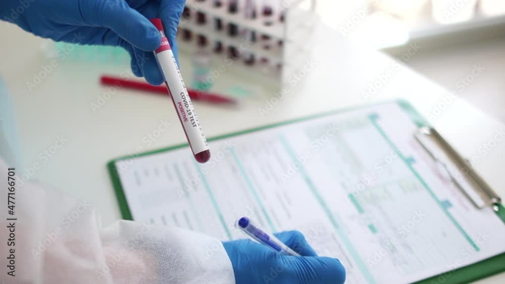 Covid 19 positive test. Mass testing for coronavirus, registration of ...
