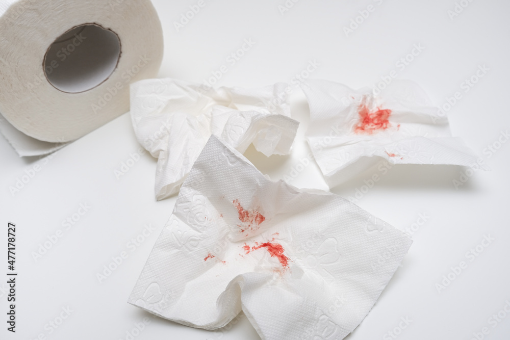 Blood on used toilet paper on white background, anal bleeding and ...