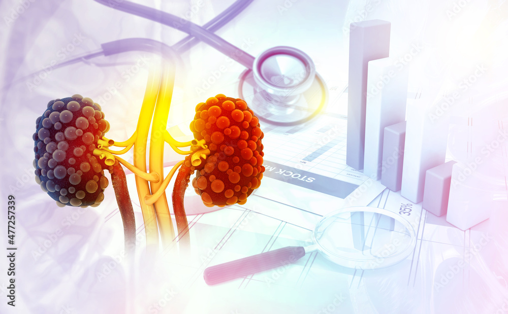 Kidney disease. Kidney cross section. Growth chart. 3d illustration ...