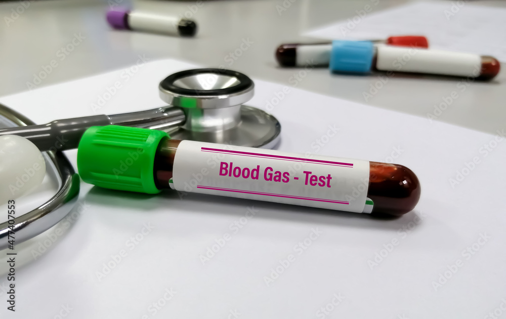 Blood sample tube for blood gas analysis Stock Photo | Adobe Stock