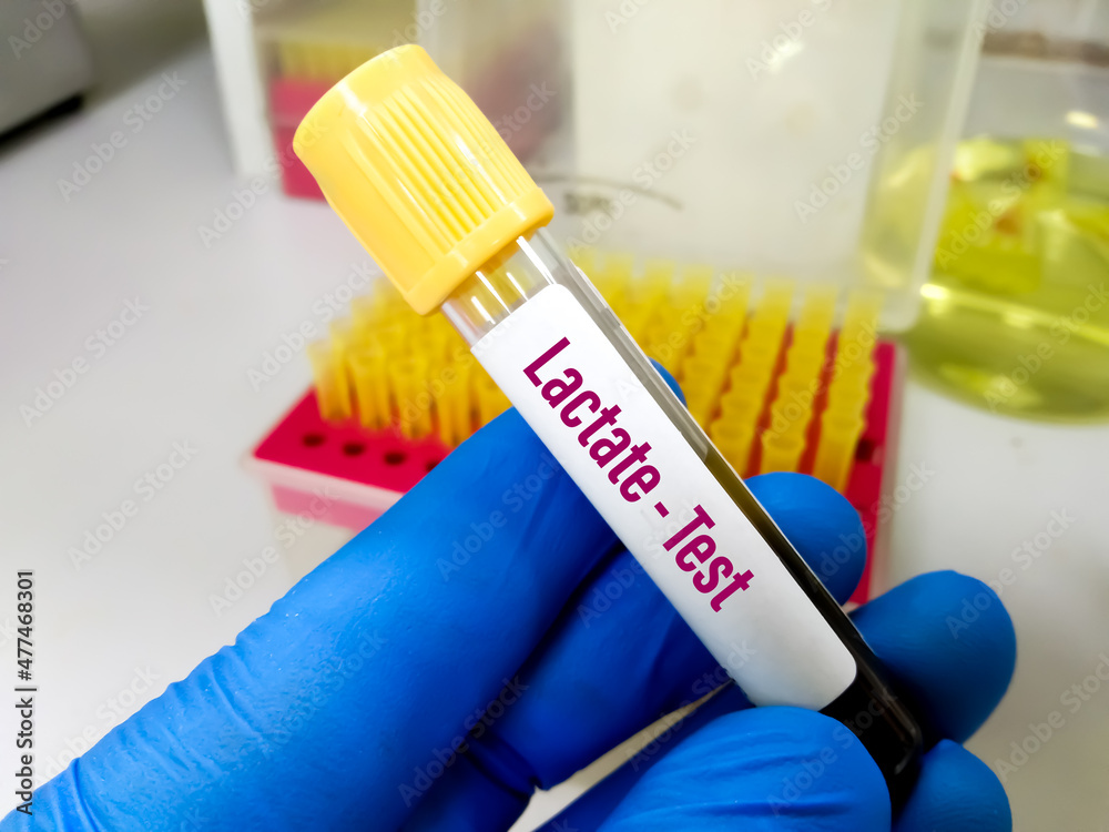 Blood sample tube for Lactate test at medical laboratory. Stock Photo ...