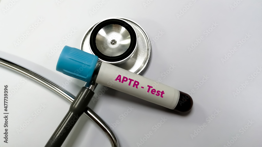 Blood sample tube for Activated Partial Thromboplastin Time Ratio (APTR ...