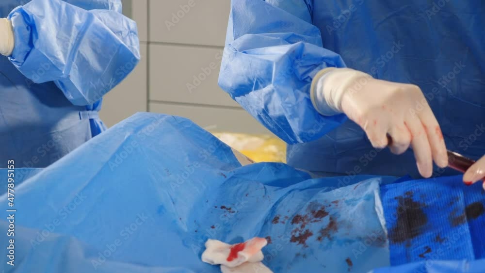 Vascular surgery in modern clinic. Professional doctors in surgical ...